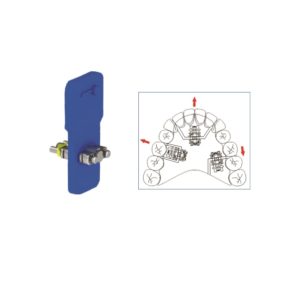 Unilateral Expansion – OrthoSourceGlobal